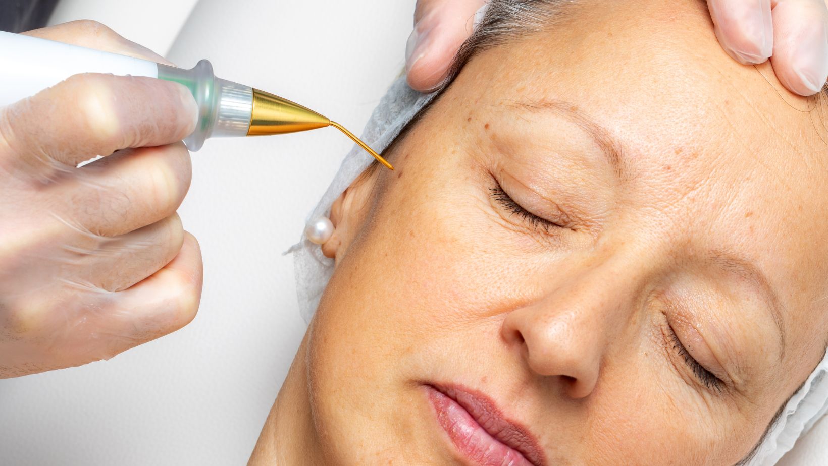 The Skin They're In: Addressing and Treating Wart Issues - Fitness TALK